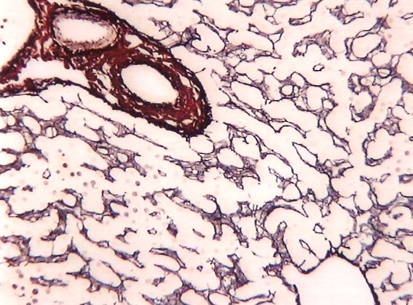 Fibrin Weigert Stain Method